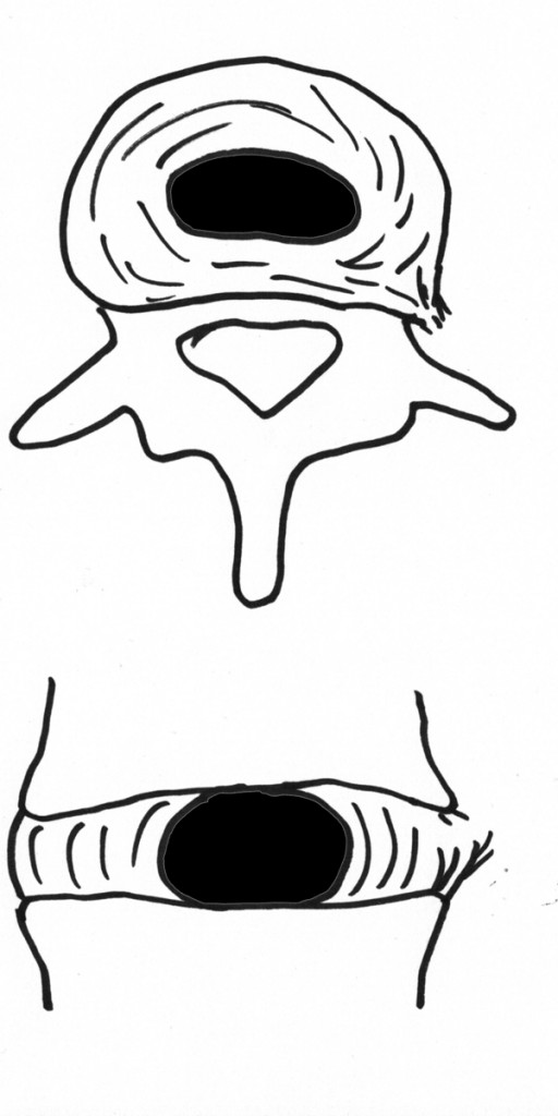 Anatomie van de rug - FysioInfo